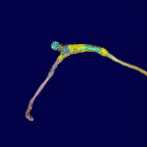 Arterial Analysis Software | Elucid