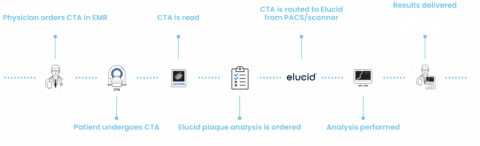 Elucid | Visualize Lesion-level Plaque Composition